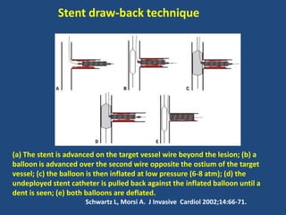 Coronary Ostial stenting techniques:Current status | PPTX
