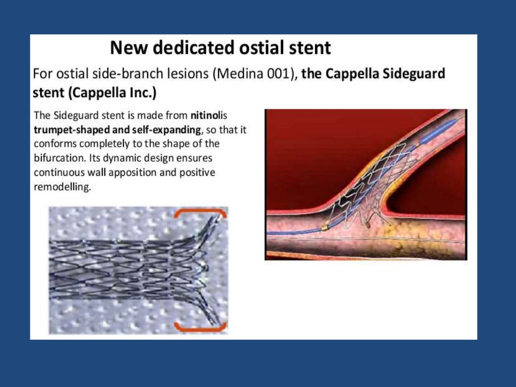 Coronary Ostial stenting techniques:Current status