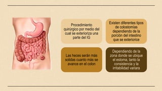 Ostomías.pptx