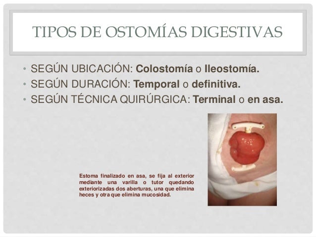 OSTOMÍAS: cuidados y consejos al paciente