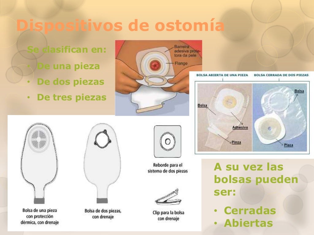 Ostomia