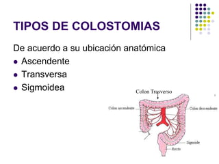Ostomias.ppt tipos de ostomas medico quirurgico | PPT