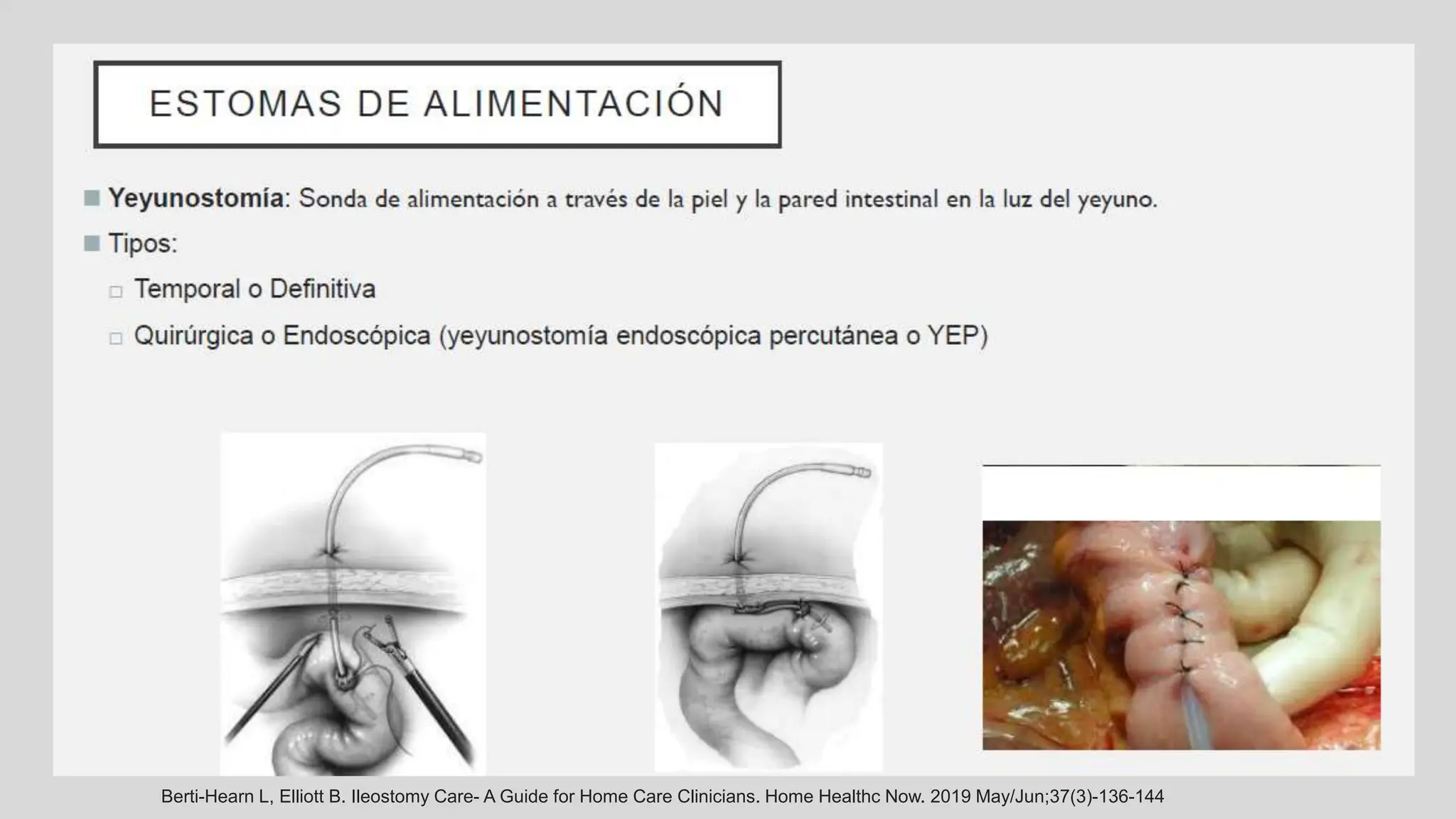 clasificacion de ostomias ficha .pptx