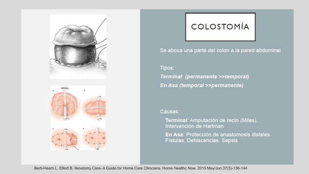 clasificacion de ostomias ficha .pptx