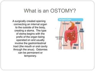 Coding Ostomies in ICD-9 & ICD-10 | PPTX