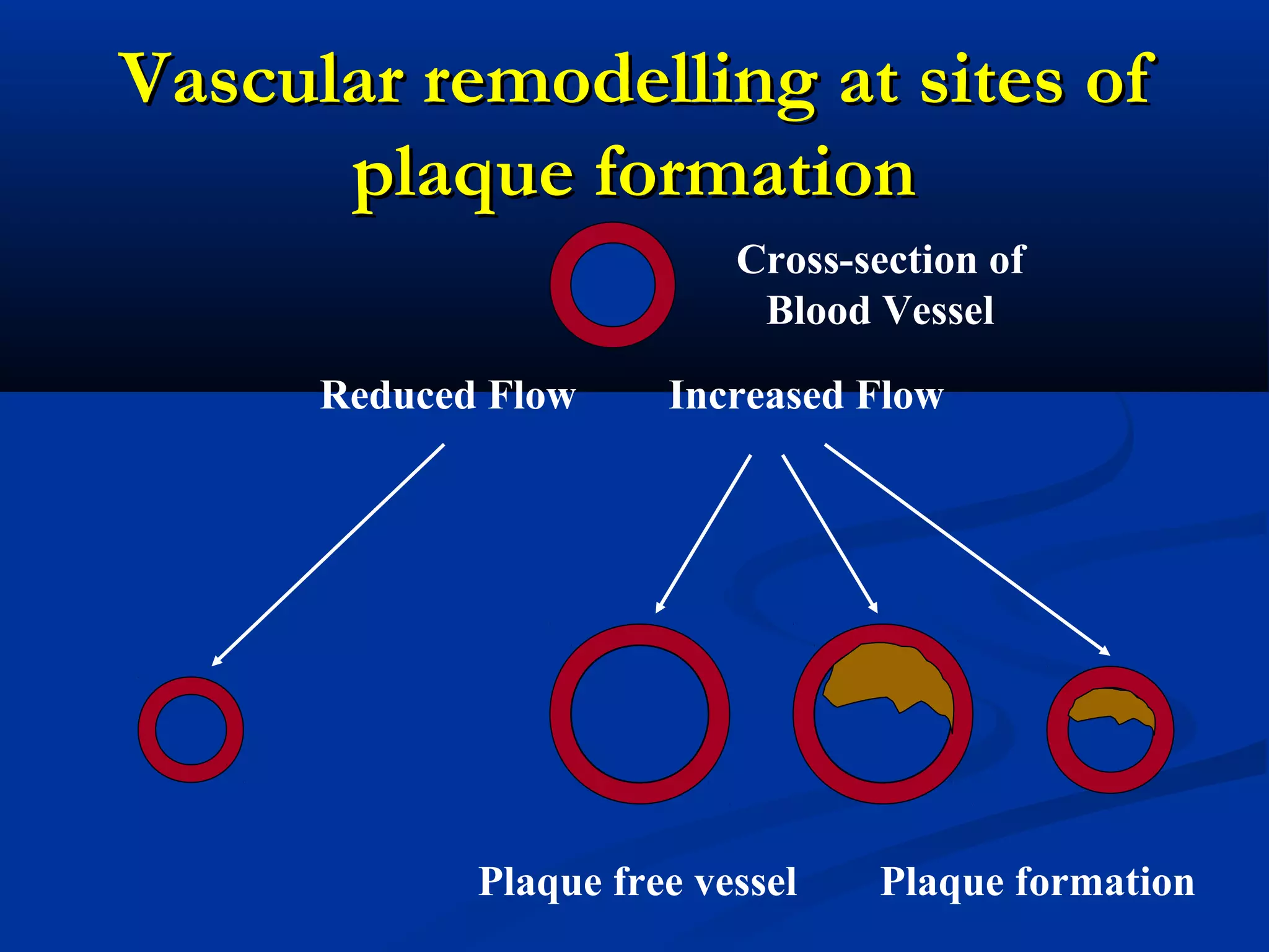 244 importance of vascular remodelling | PPT