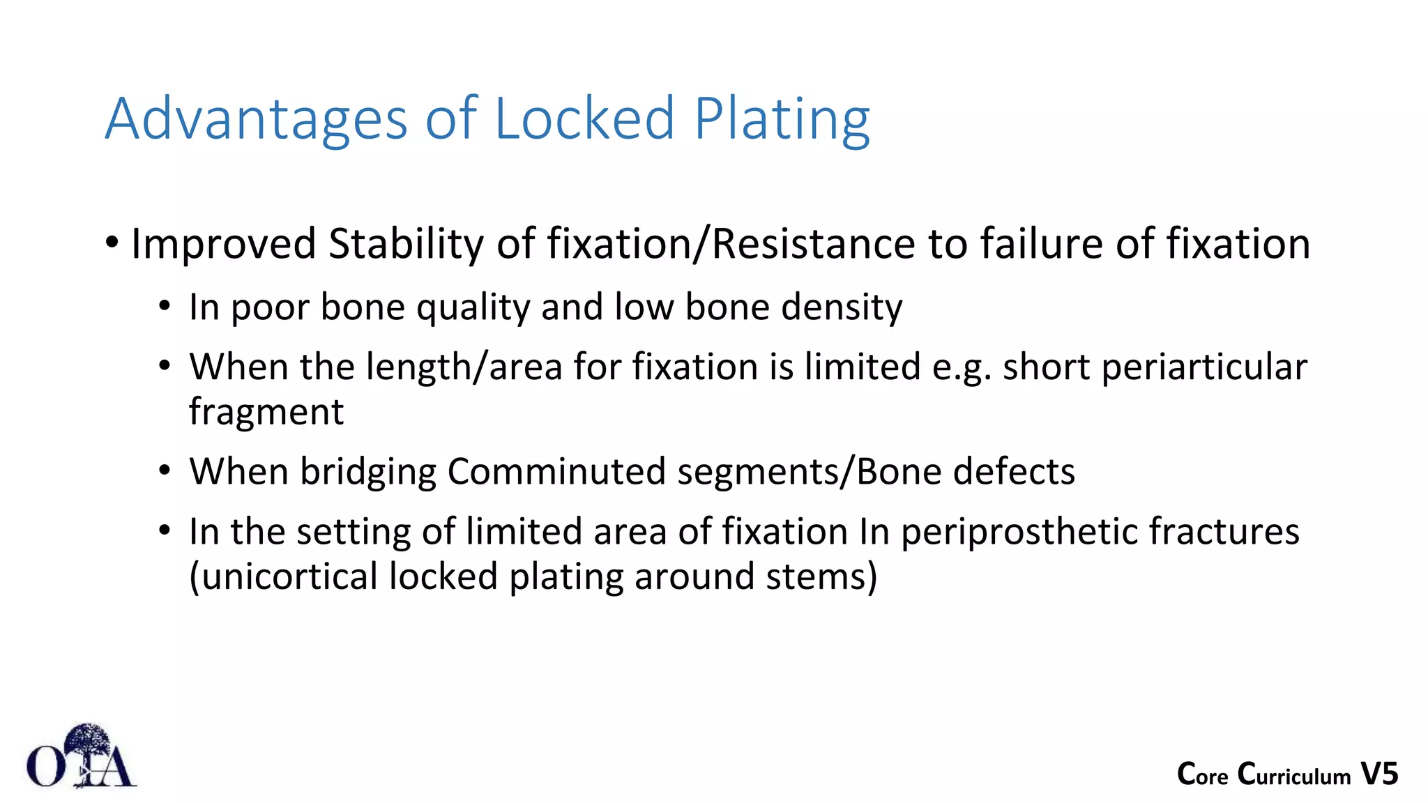 Locking Plates in Orthopaedic | PPTX