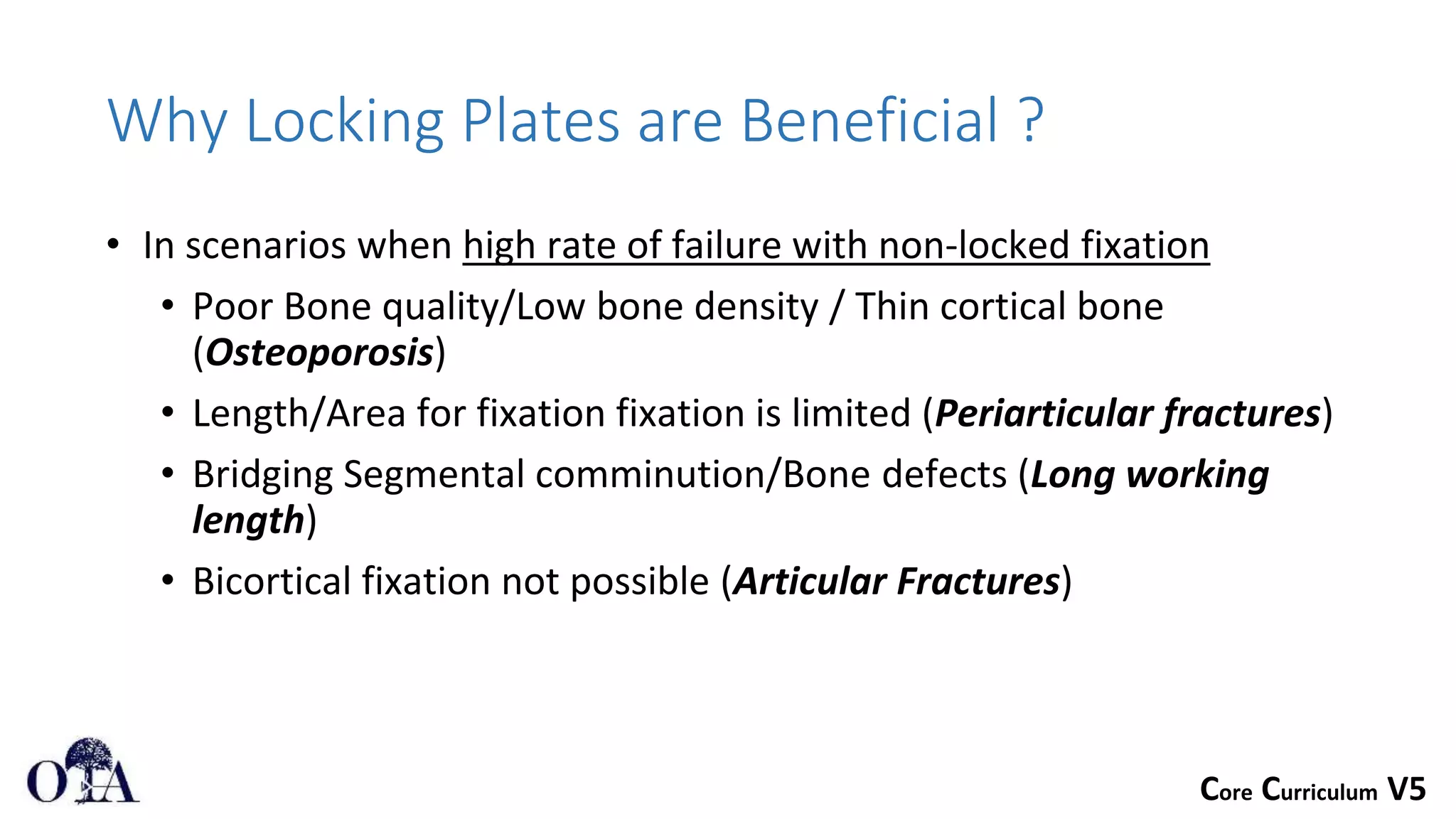 Locking Plates in Orthopaedic | PPTX