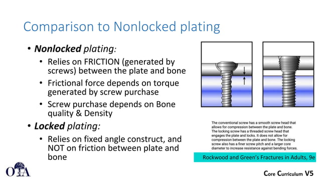 Locking Plates in Orthopaedic | PPTX | Death, Injury, or Military ...