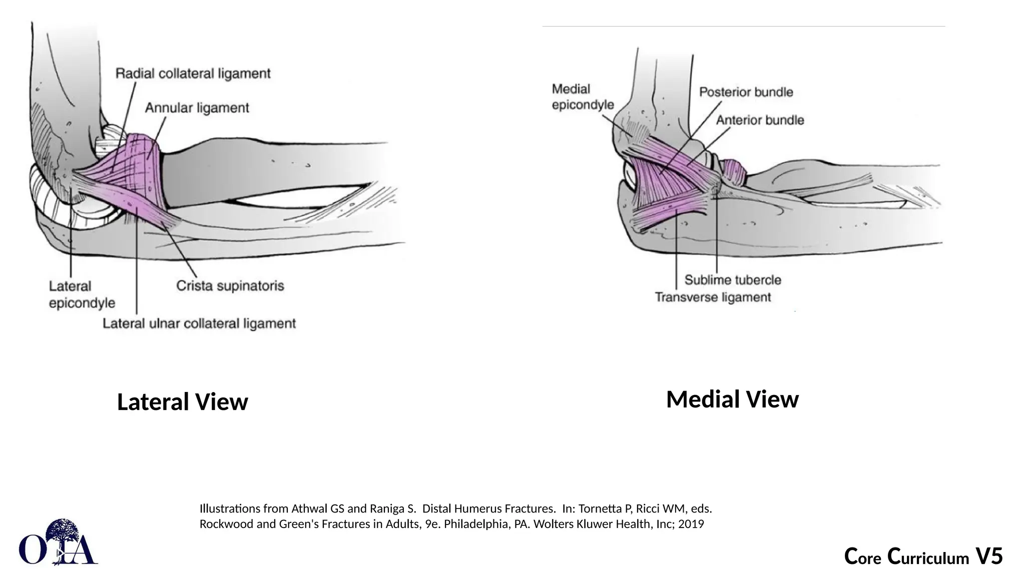ota_Fractures of the Distal Humerus.pptx