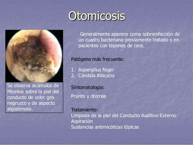 Otalgia
