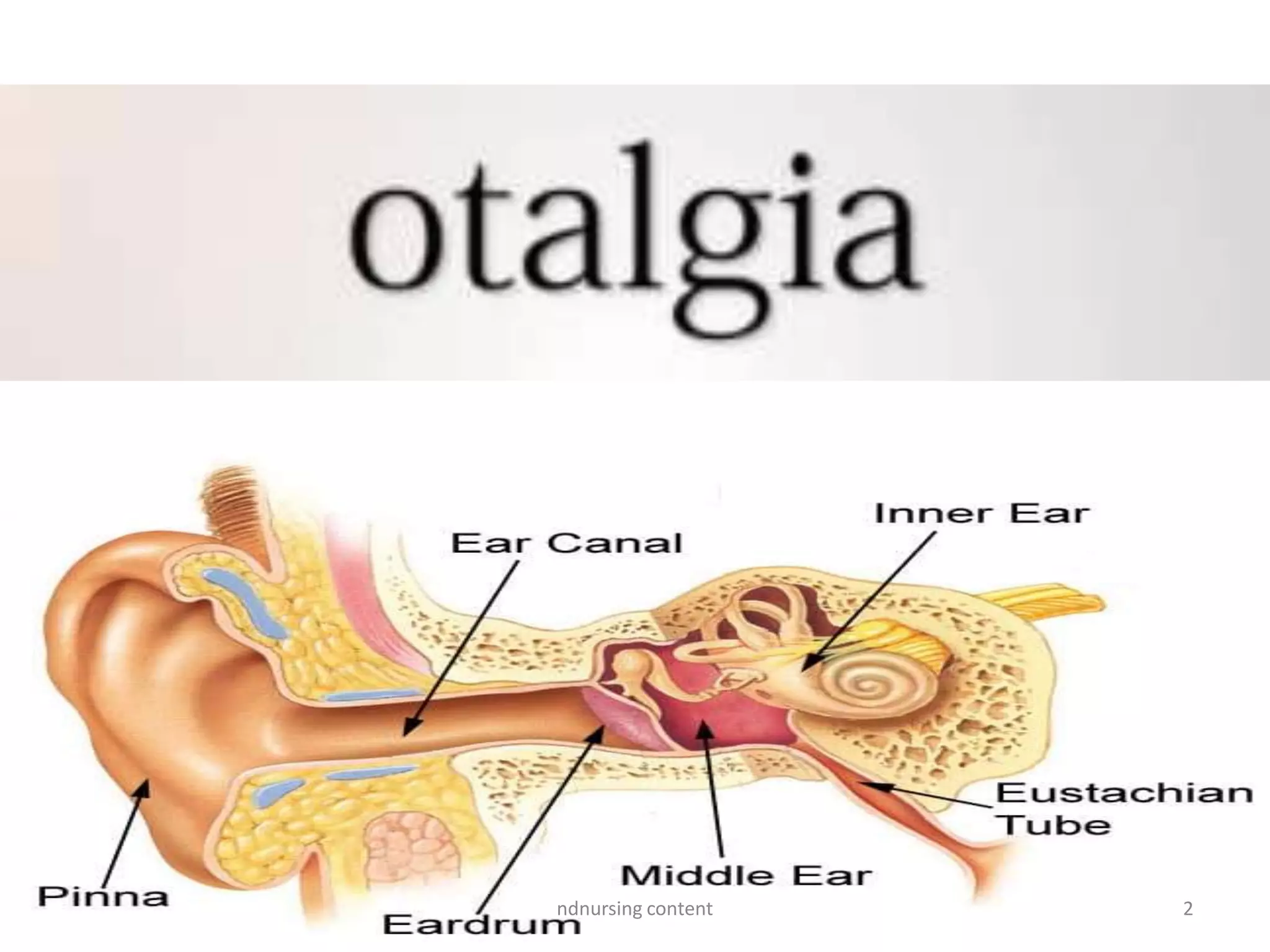 Otalgia | PPTX