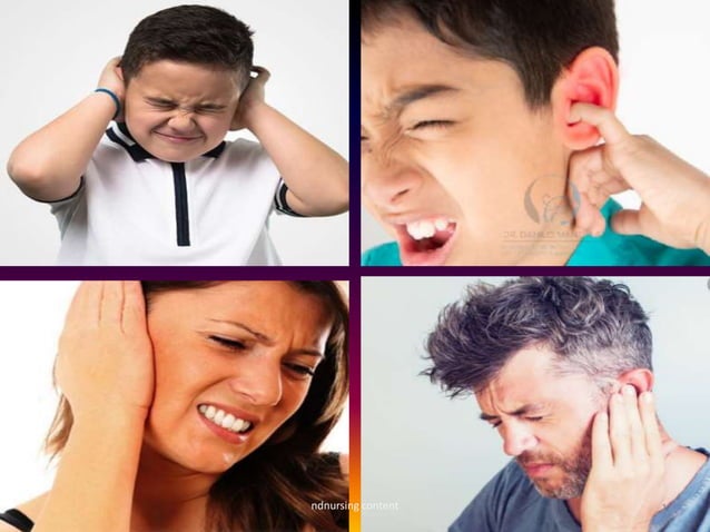Otalgia | PPTX | Ear, Nose and Throat Conditions | Diseases and Conditions