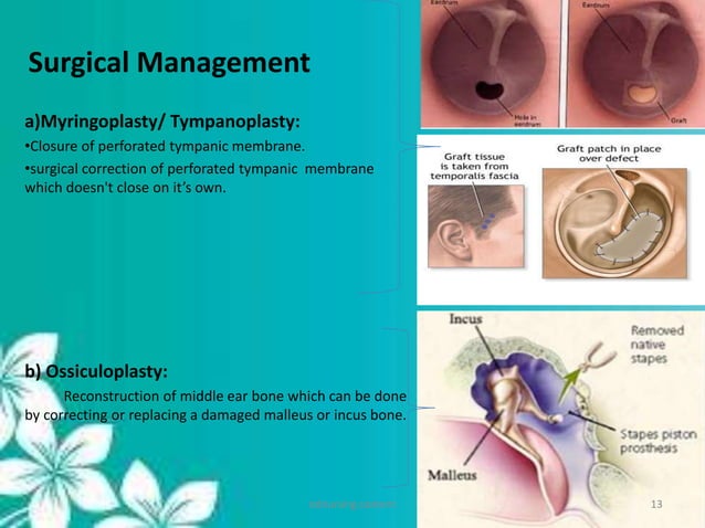 Otalgia | PPTX | Ear, Nose and Throat Conditions | Diseases and Conditions