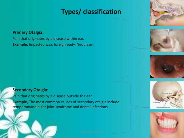 Otalgia | PPTX | Ear, Nose and Throat Conditions | Diseases and Conditions