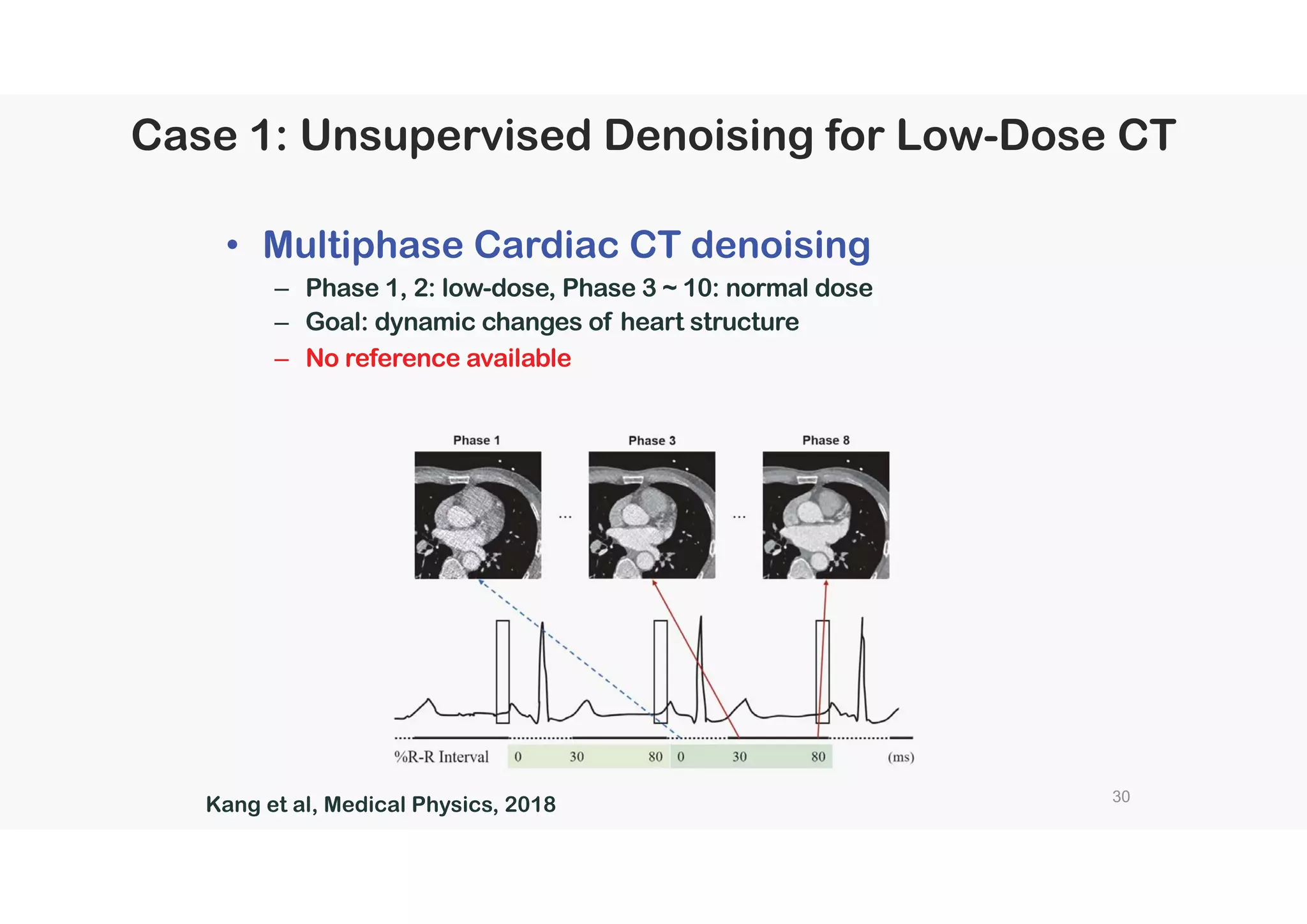Optimal transport driven CycleGAN for unsupervised learning in inverse problems | PDF