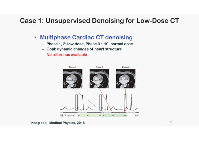 Optimal transport driven CycleGAN for unsupervised learning in inverse problems | PDF