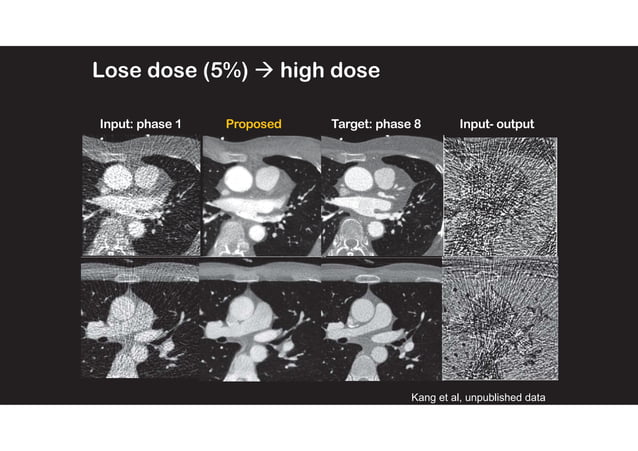 Optimal transport driven CycleGAN for unsupervised learning in inverse problems | PDF