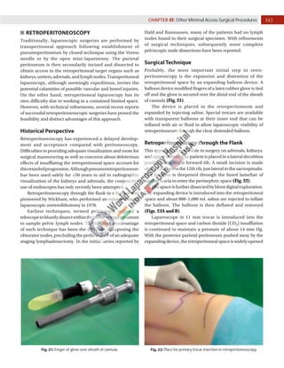 Other Minimal Access Surgical Procedures | PDF