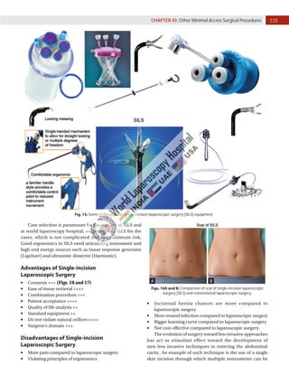 Other Minimal Access Surgical Procedures | PDF