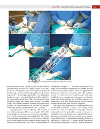 Other Minimal Access Surgical Procedures | PDF