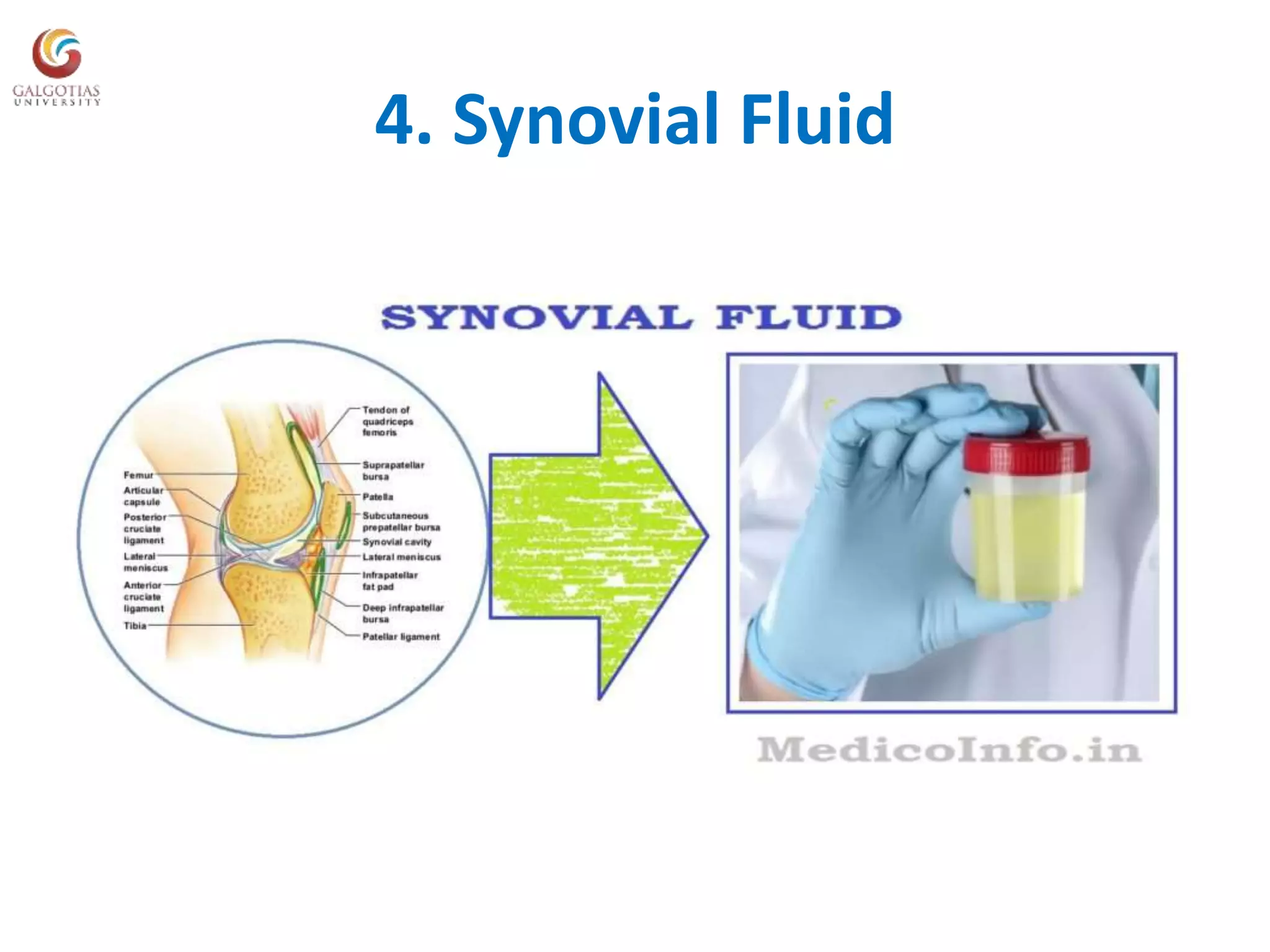 other body fluids pericardial, peritonial,synovial,pleural | PPTX