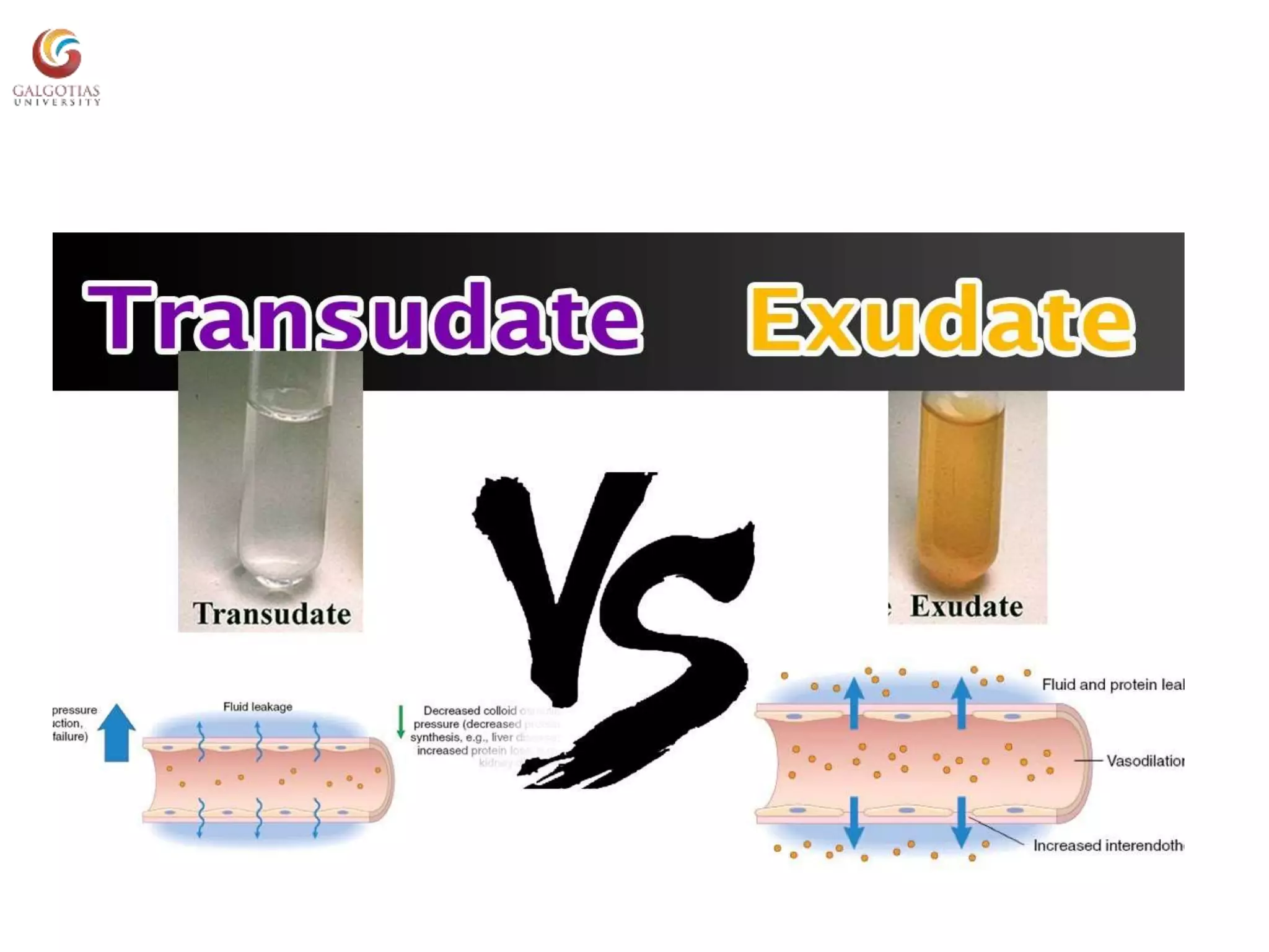 Other body fluids | PPTX