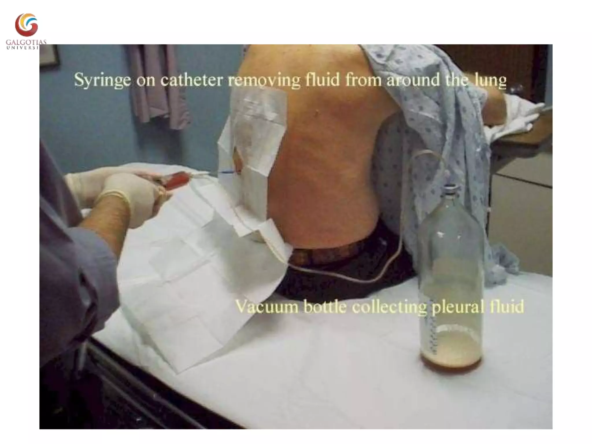 Other body fluids | PPTX