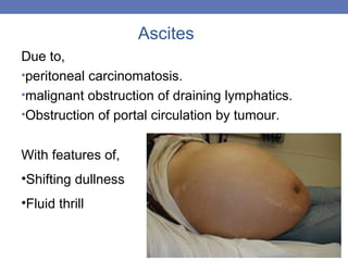 Other clinical features of gastric carcinoma | PPT | Digestive ...