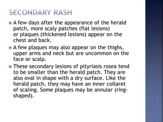 Other cutaneous problems associated with viral infections | PPTX
