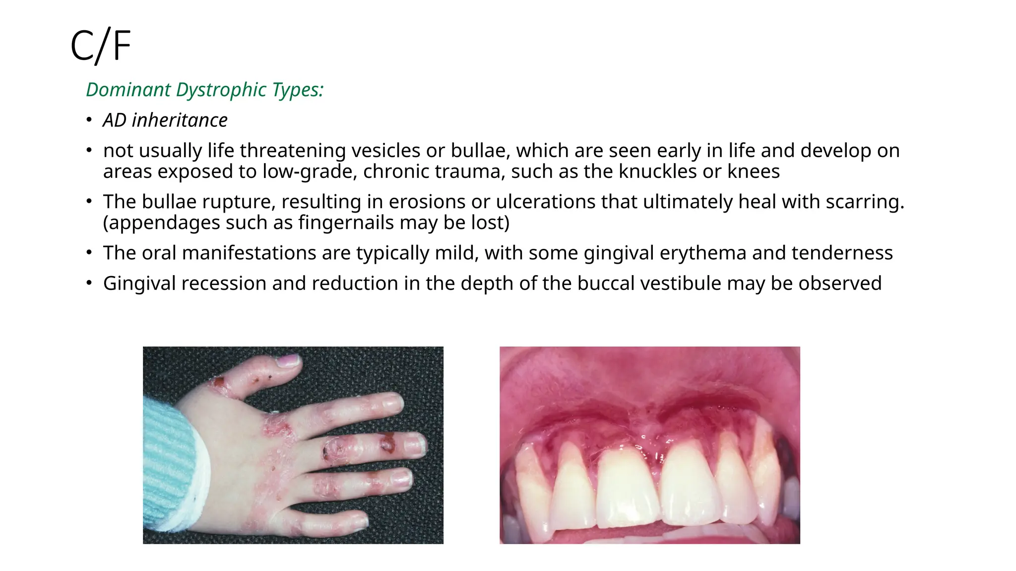 other derma lesions in oral cavity and genodermatosis | PPT