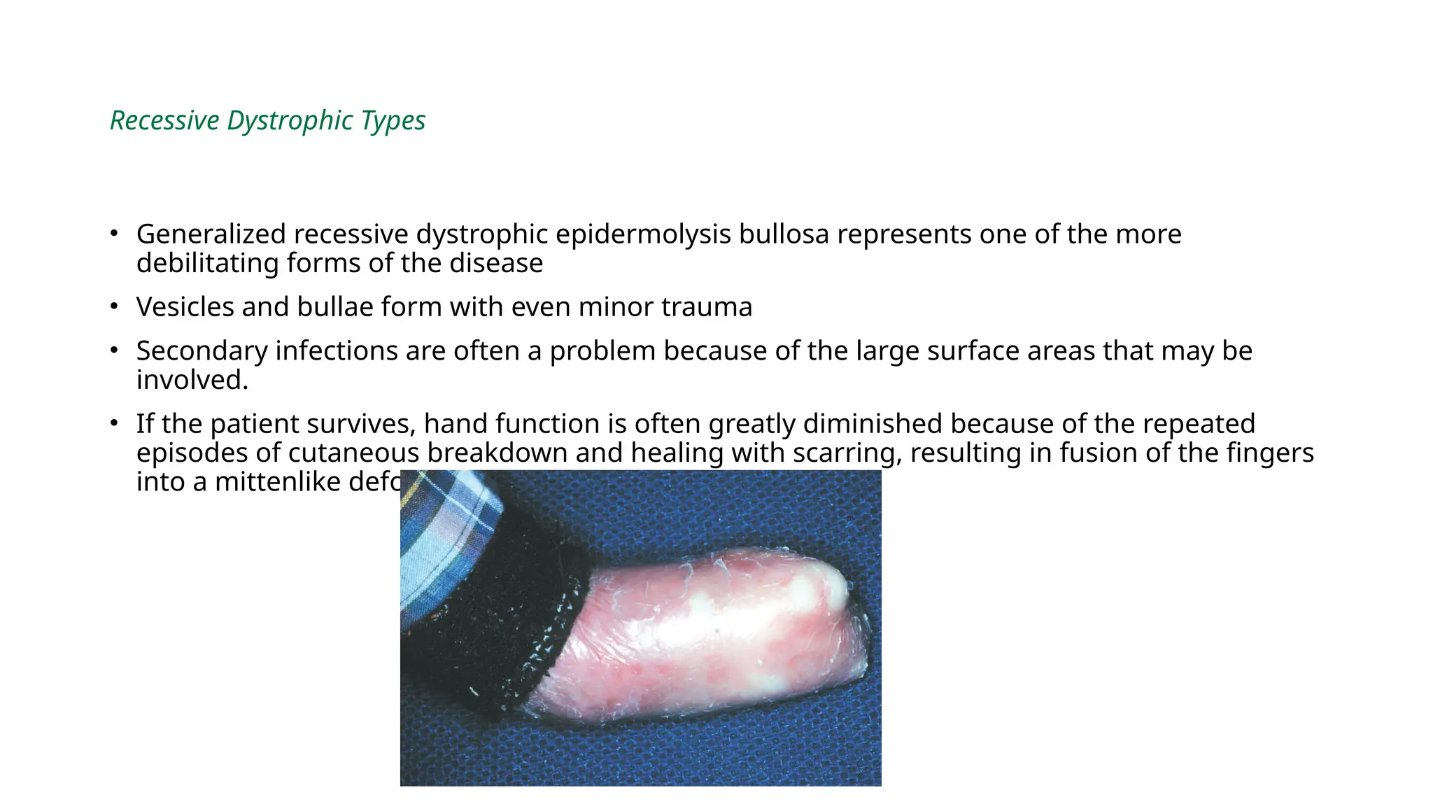 other derma lesions in oral cavity and genodermatosis | PPT