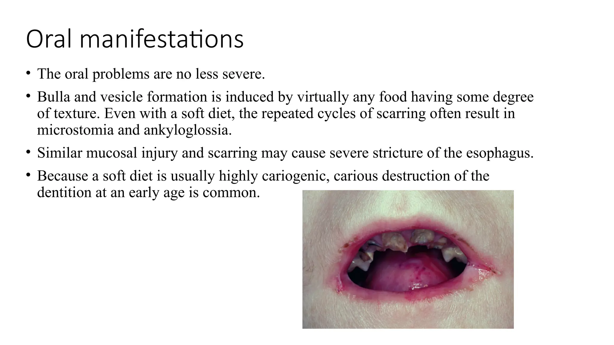 other derma lesions in oral cavity and genodermatosis | PPT