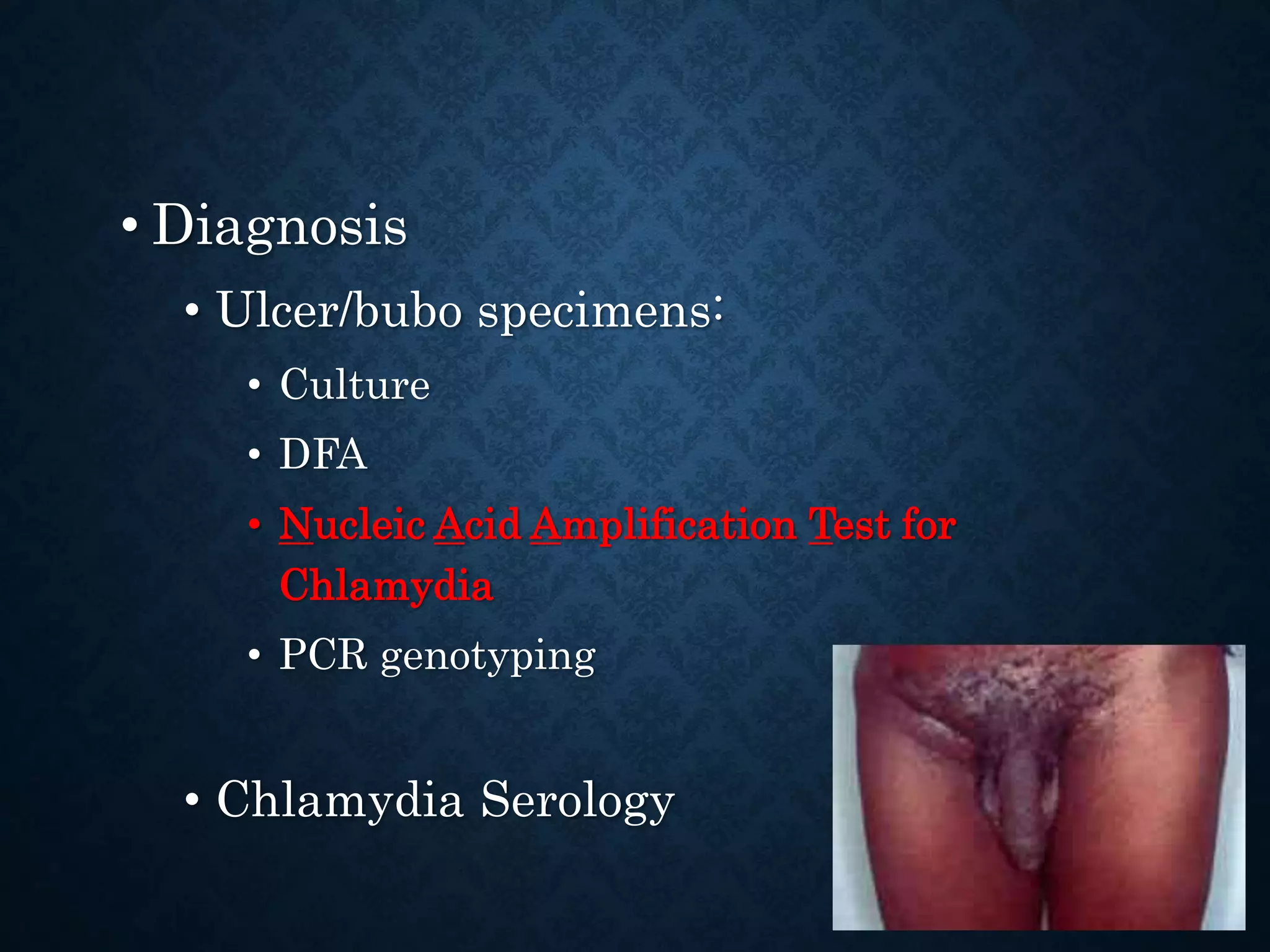 Stds Genital Ulcer Ppt