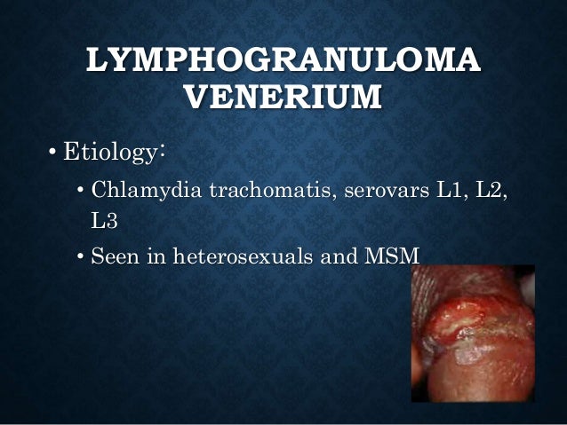 STD’S – GENITAL ULCER