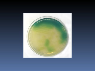 Other Gram Negative Bacilli | PPT