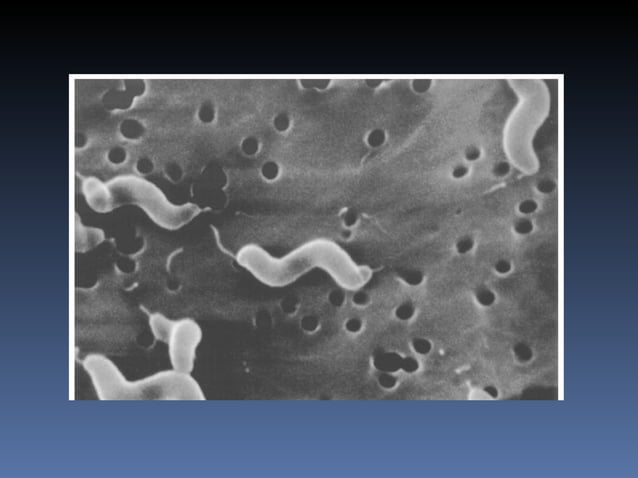 Other Gram Negative Bacilli | PPT