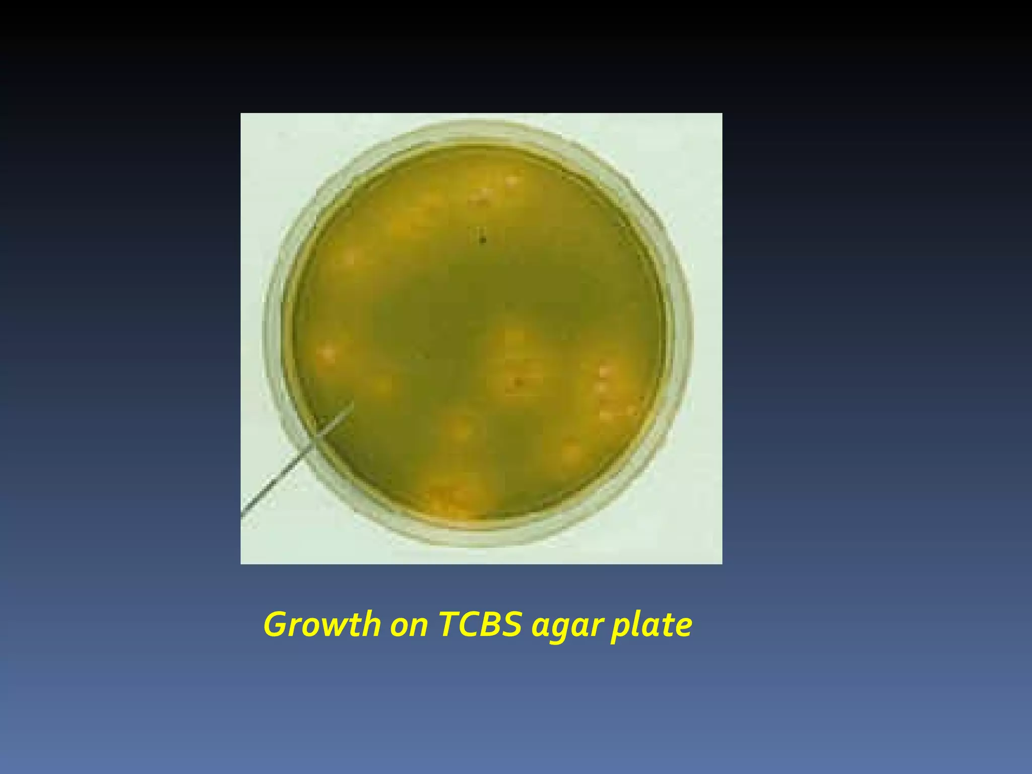 Other Gram Negative Bacilli | PPT