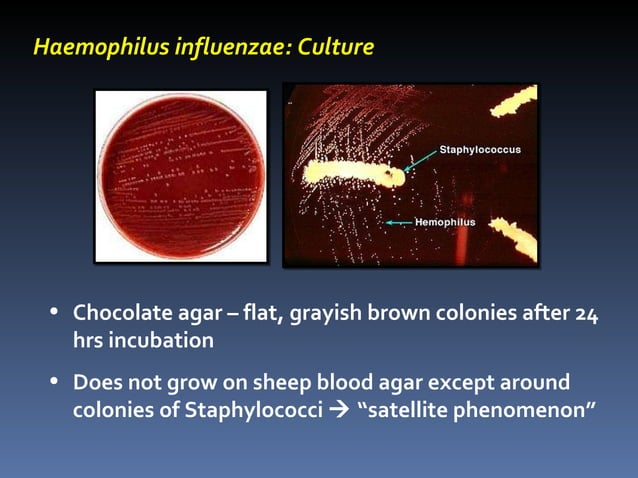 Other Gram Negative Bacilli | PPT