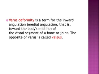 Other joint disorders | PPTX