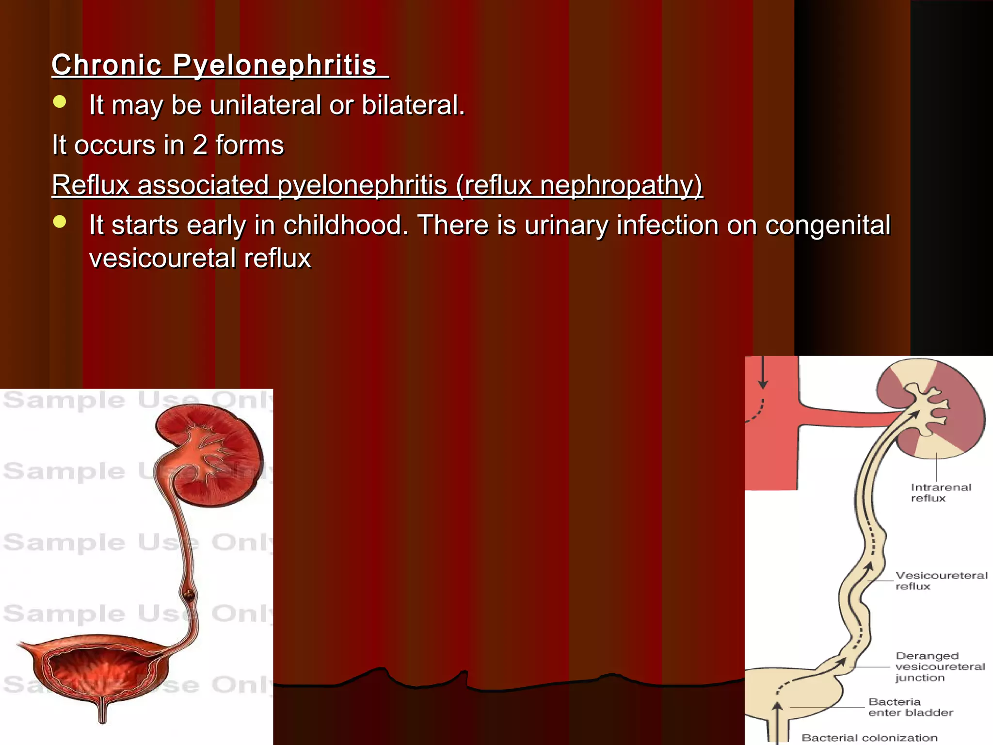 Other renal pathology | PPT