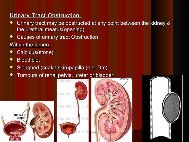 Other renal pathology | PPT