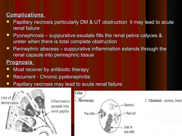Other renal pathology | PPT