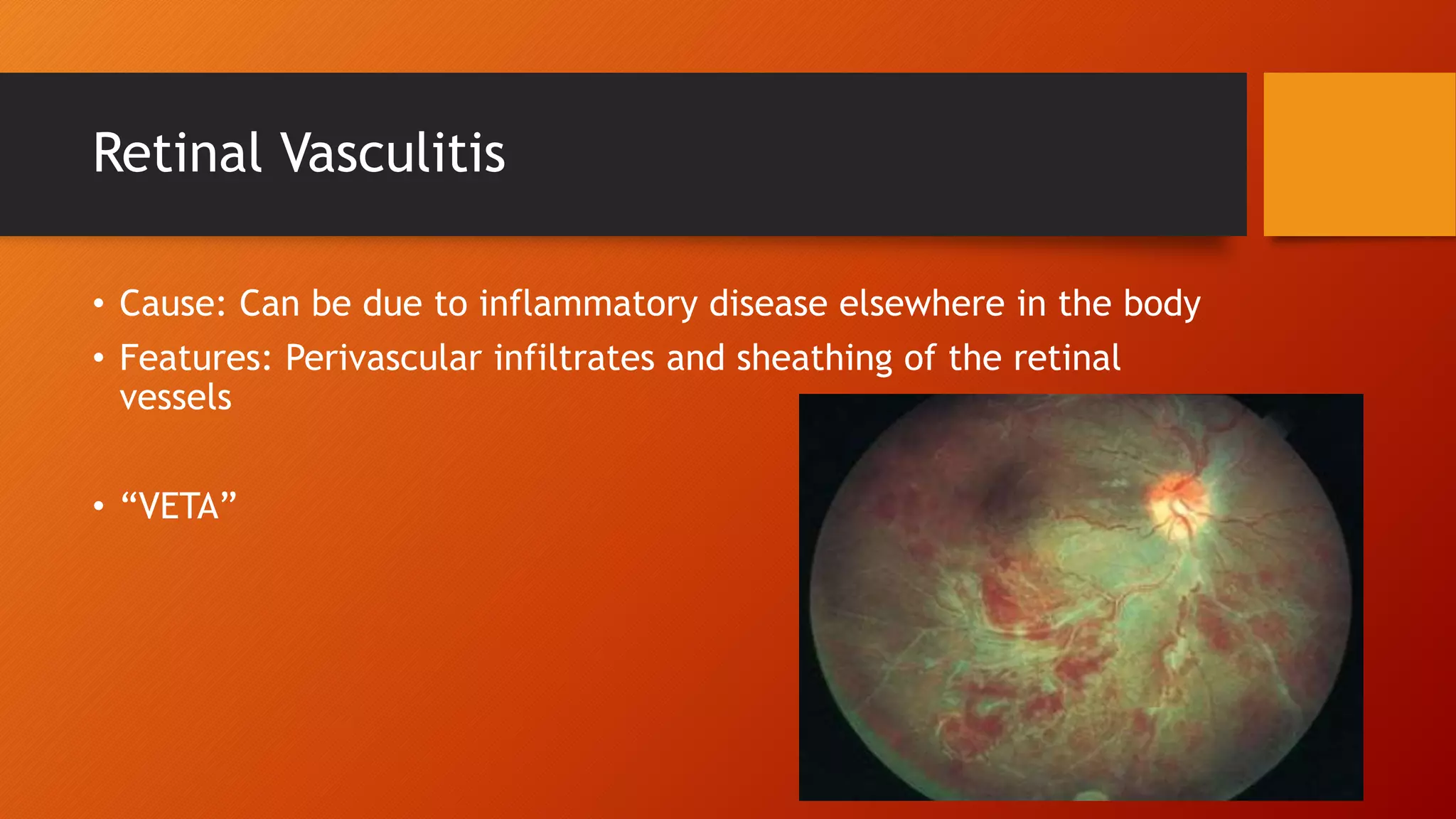 OTHER RETINAL VASCULAR DISEASES by Iddi.pptx