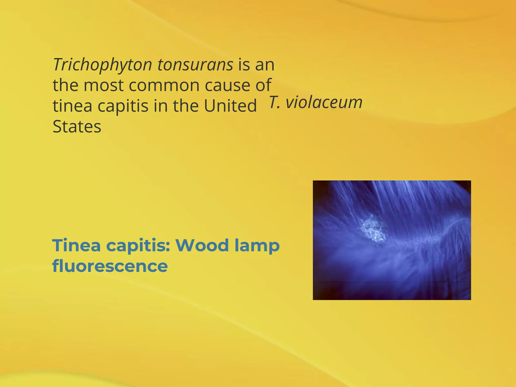 other types of tineas.pdf