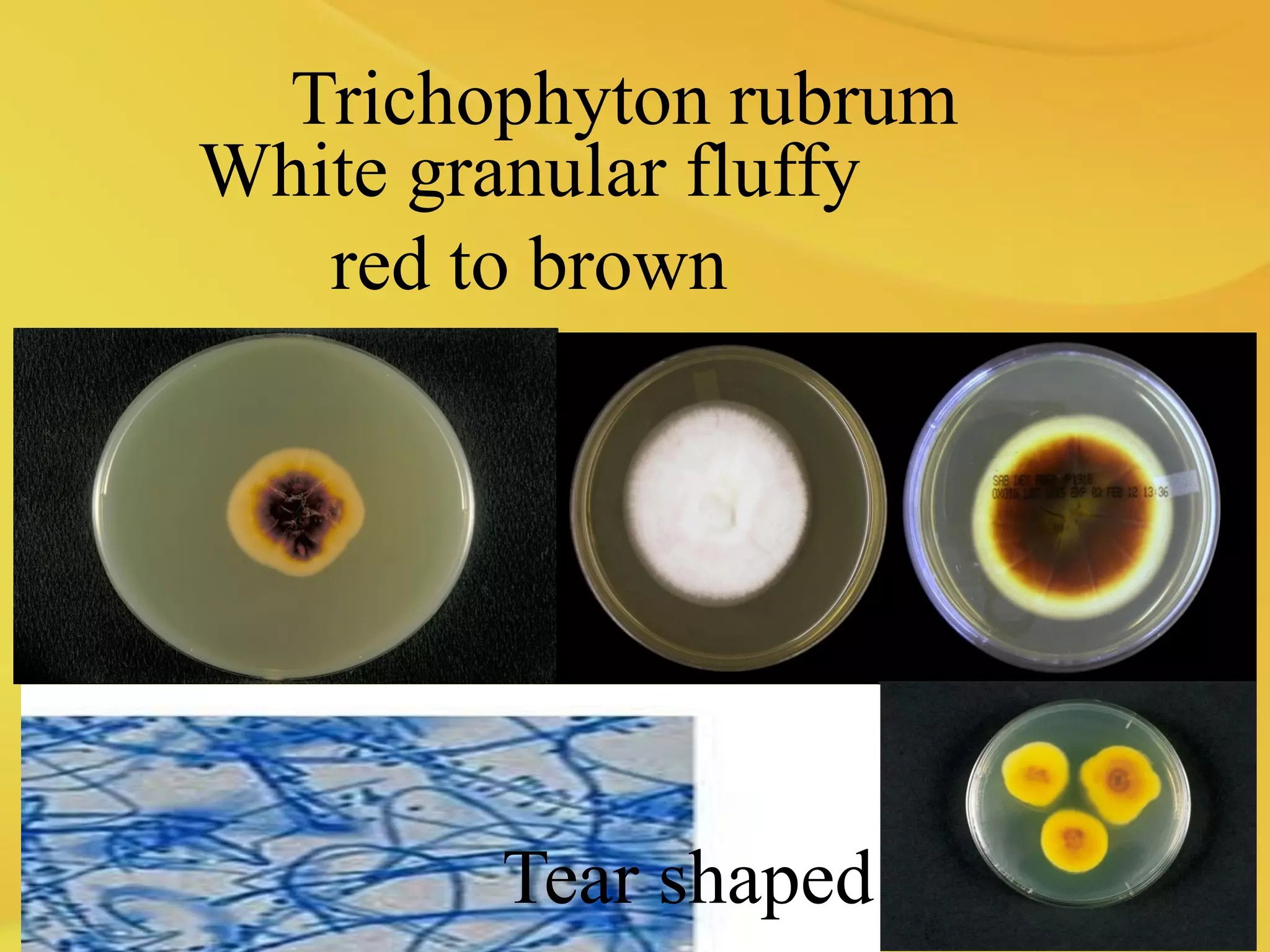 other types of tineas.pdf