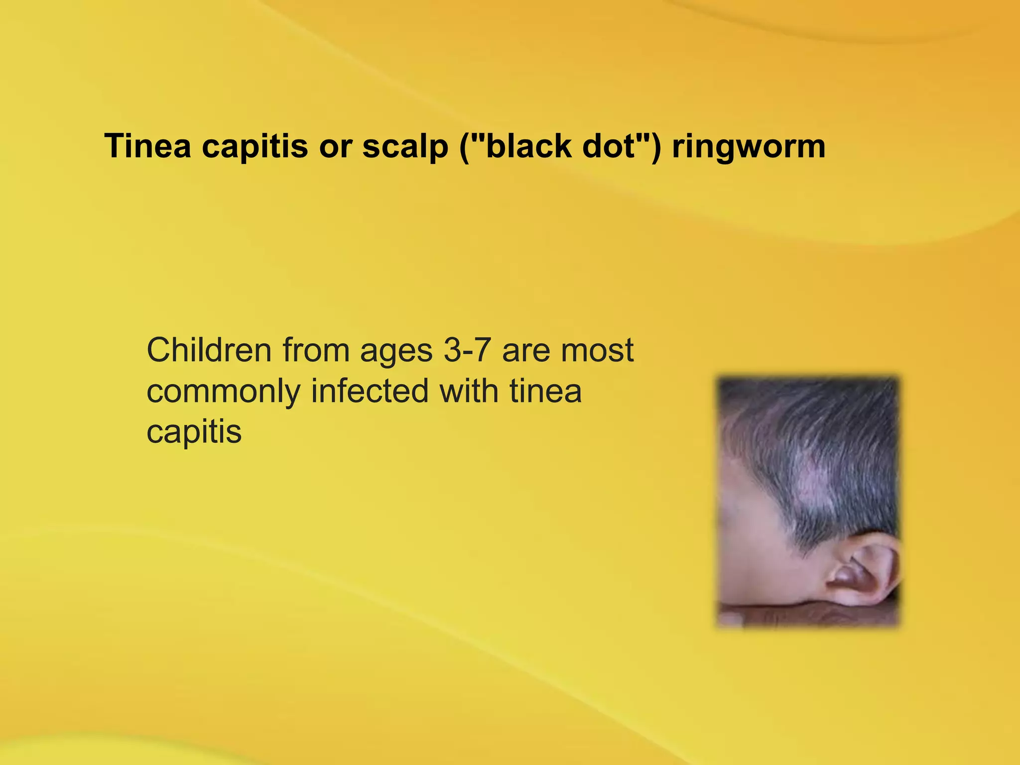 other types of tineas.pdf