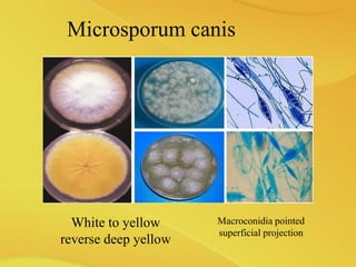 Microsporum Canis Culture