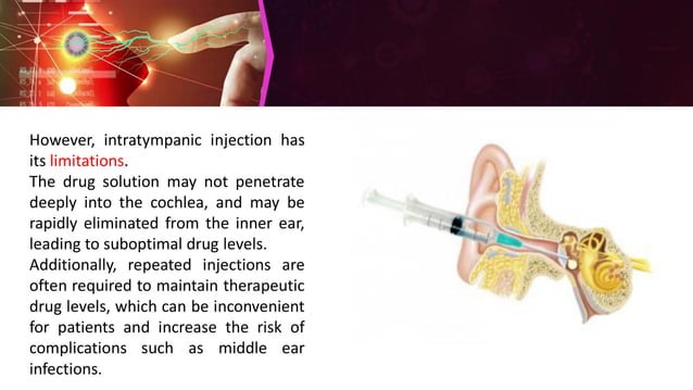 otic delivery system.pdf