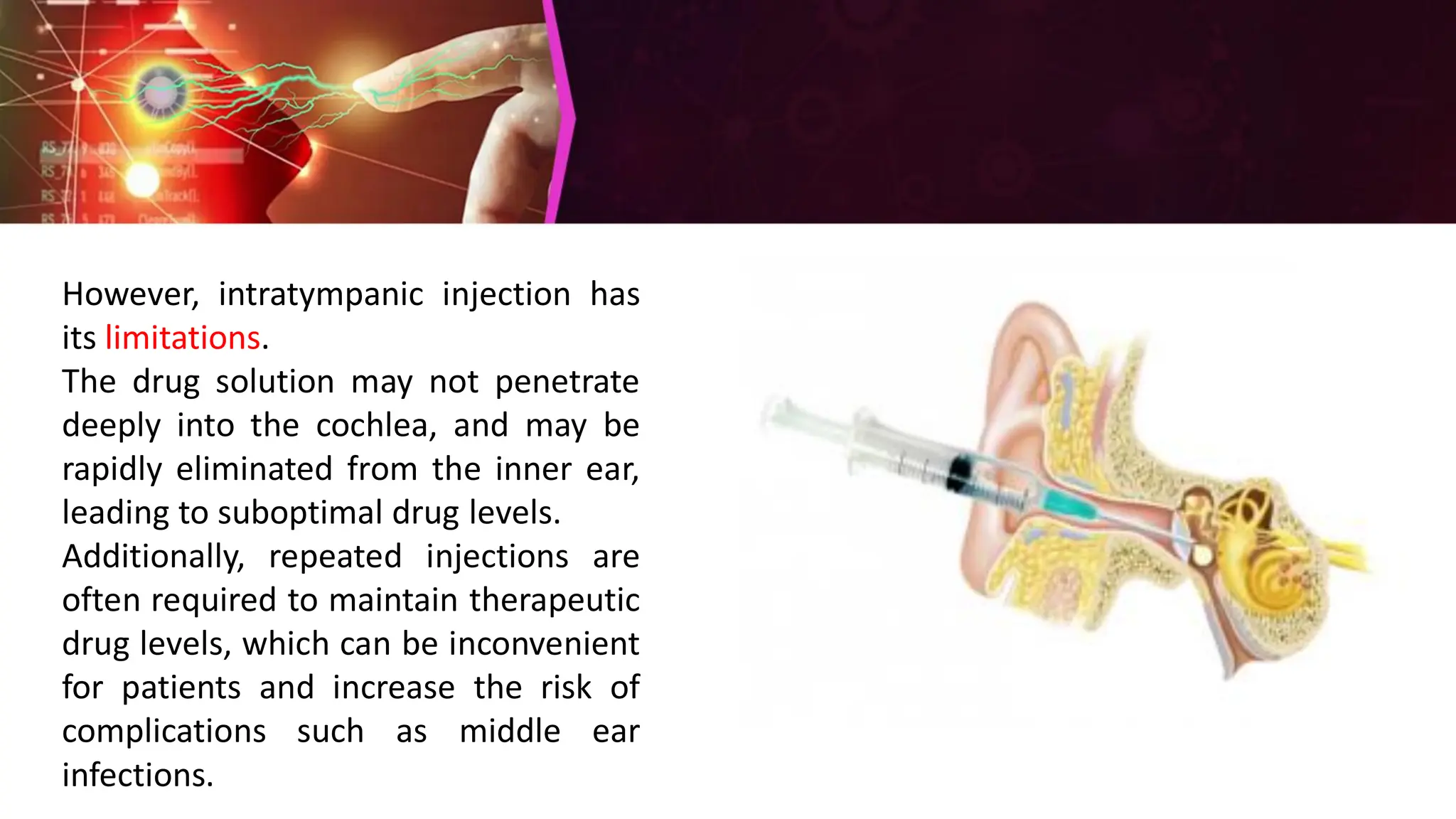 otic delivery system.pdf